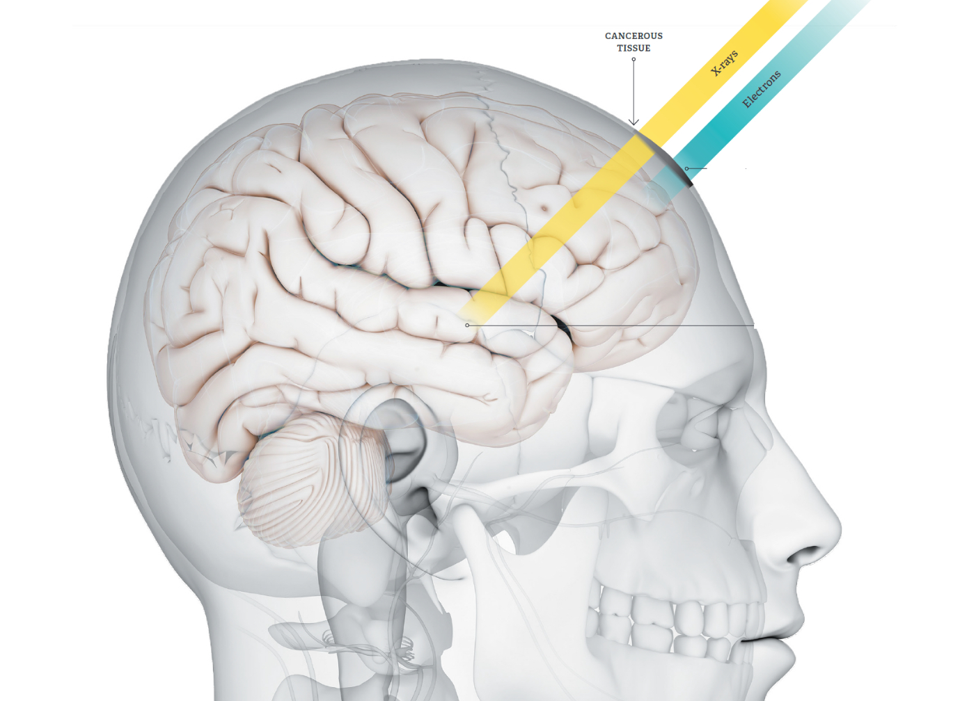 IntraOp | AMG-Medtech Ltd